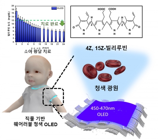 KAIST, 웨어러블 OLED로 신생아 황달 치료…기존 병원 대비 효과적